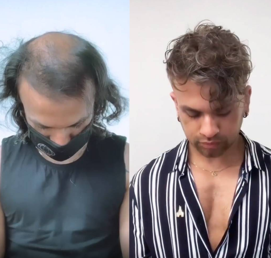 What Are Best Wigs for Men - What Kind of Wig Will Become a Man's Favorite What Are Best Wigs for Men - What Kind of Wig Will Become a Man's Favorite